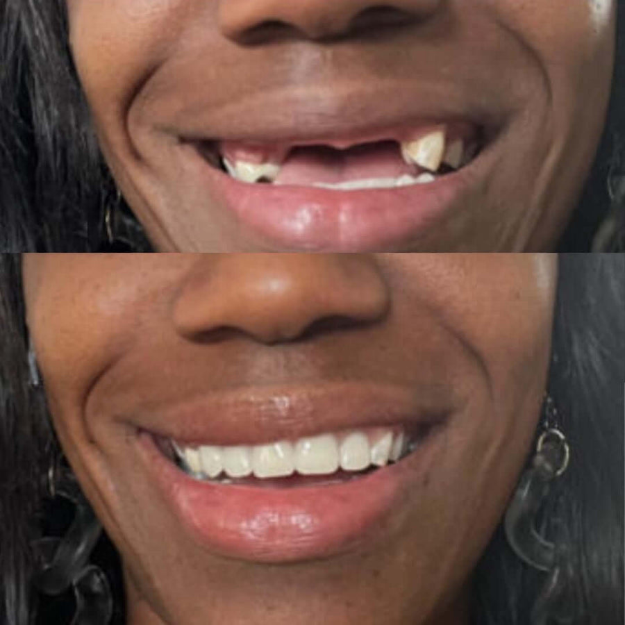 Revived Smiles l Affordable At-Home Dental Appliances