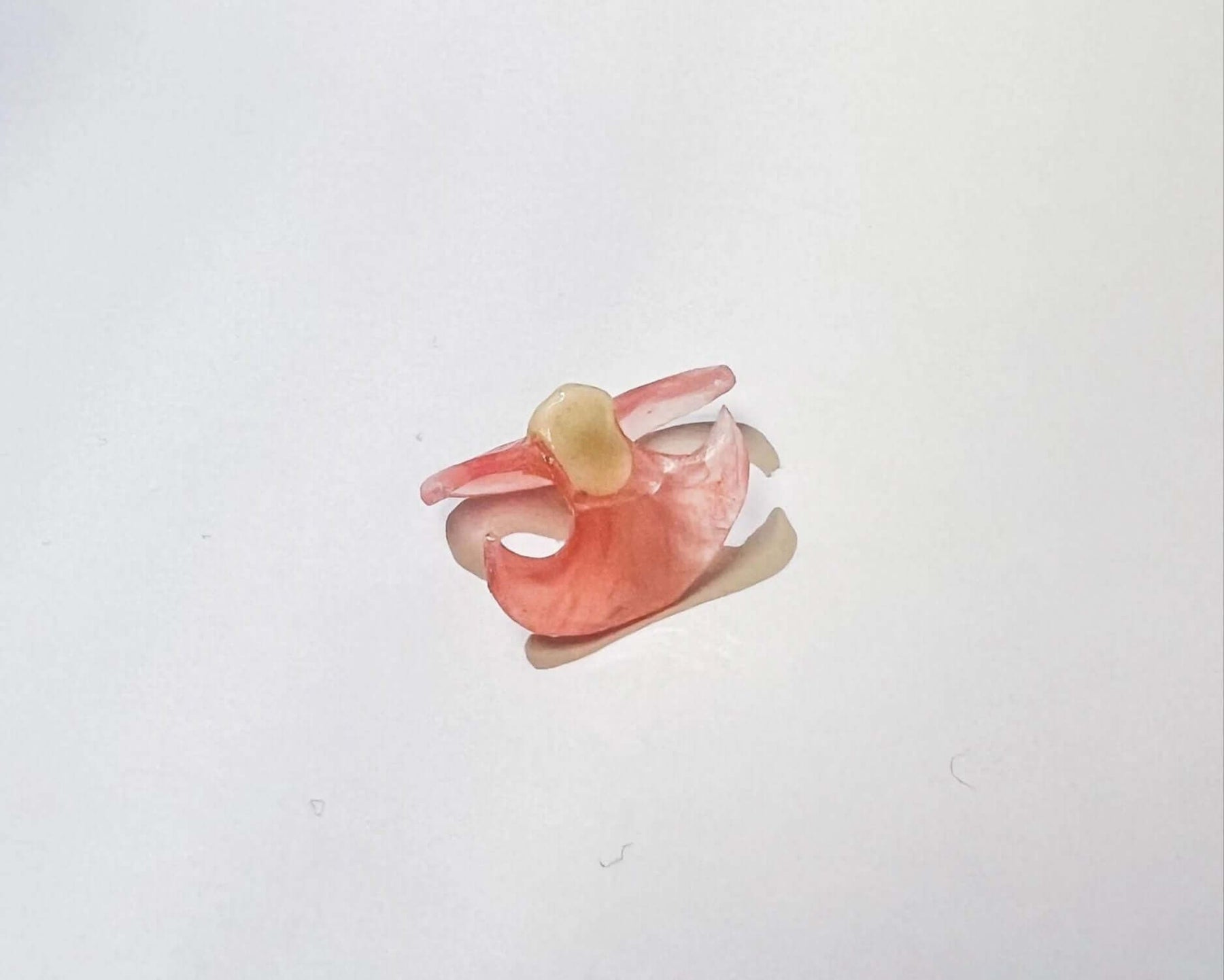 Affordable Unilateral Partial Denture – Restore Your Smile