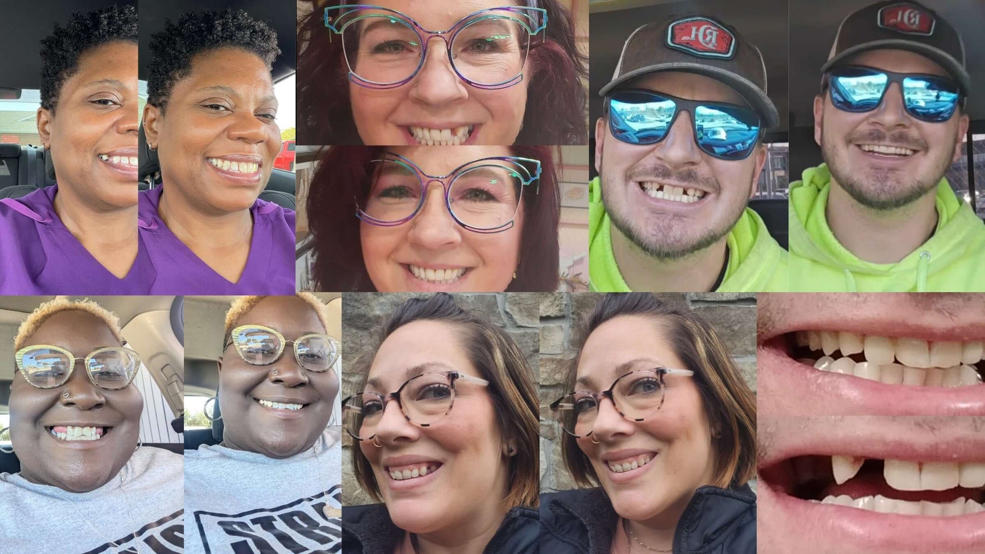 Revived Smiles l Affordable At-Home Dental Appliances