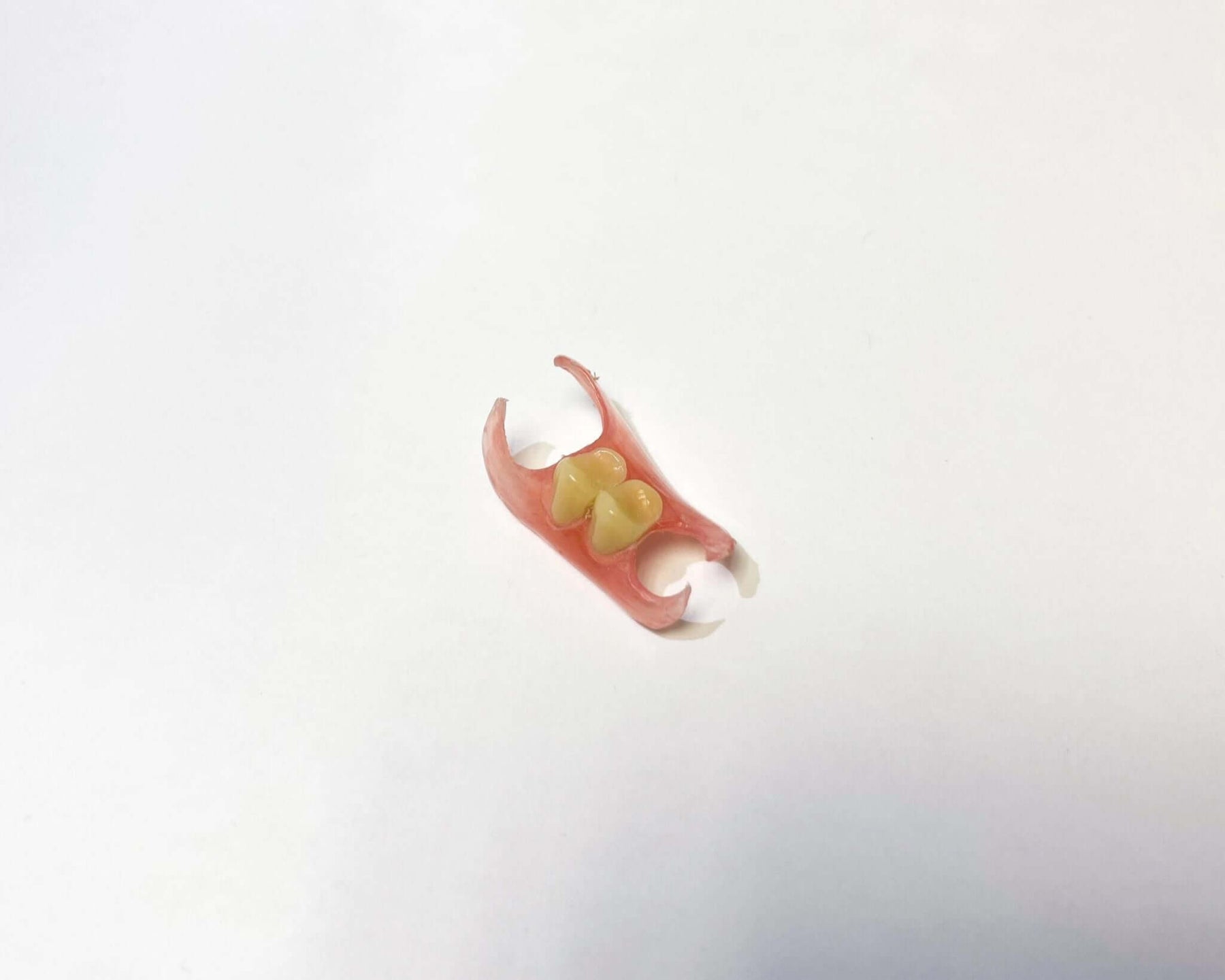 Affordable Unilateral Partial Denture – Restore Your Smile
