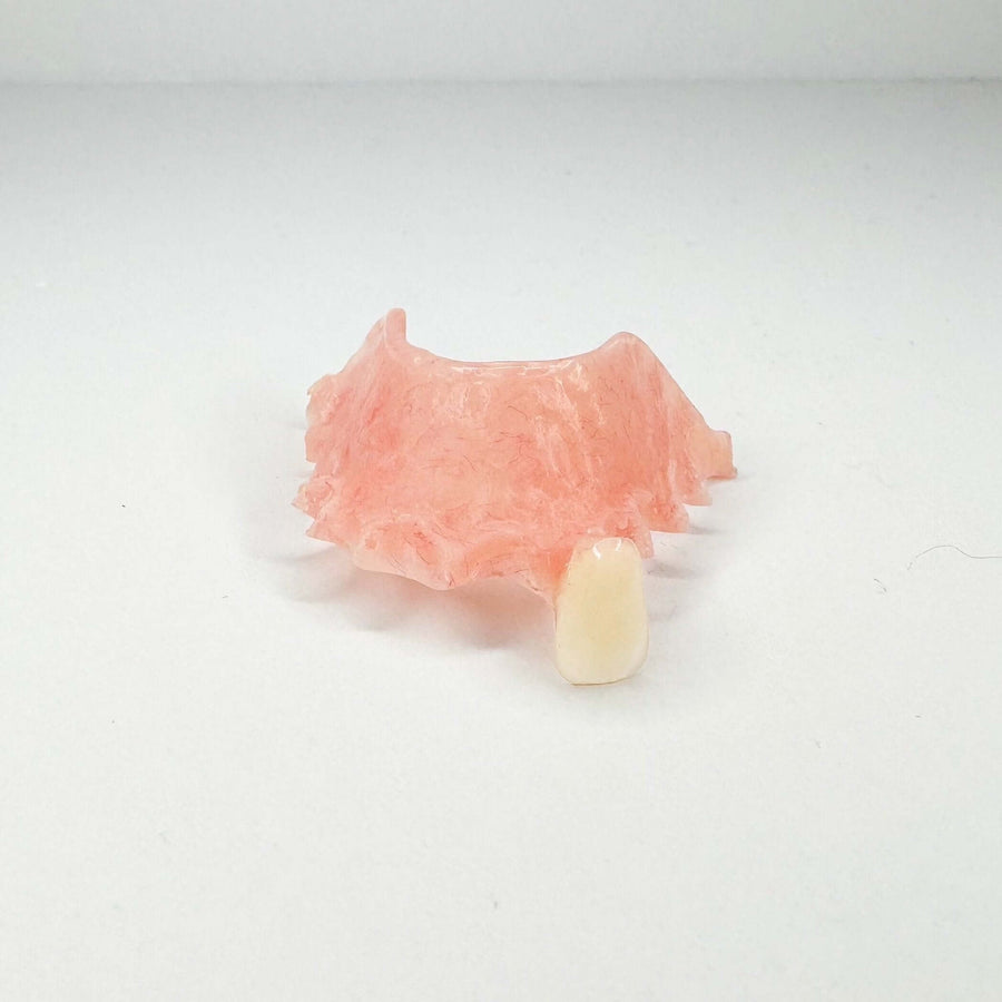 Affordable Acrylic Partial Denture Flipper - Revived Smiles