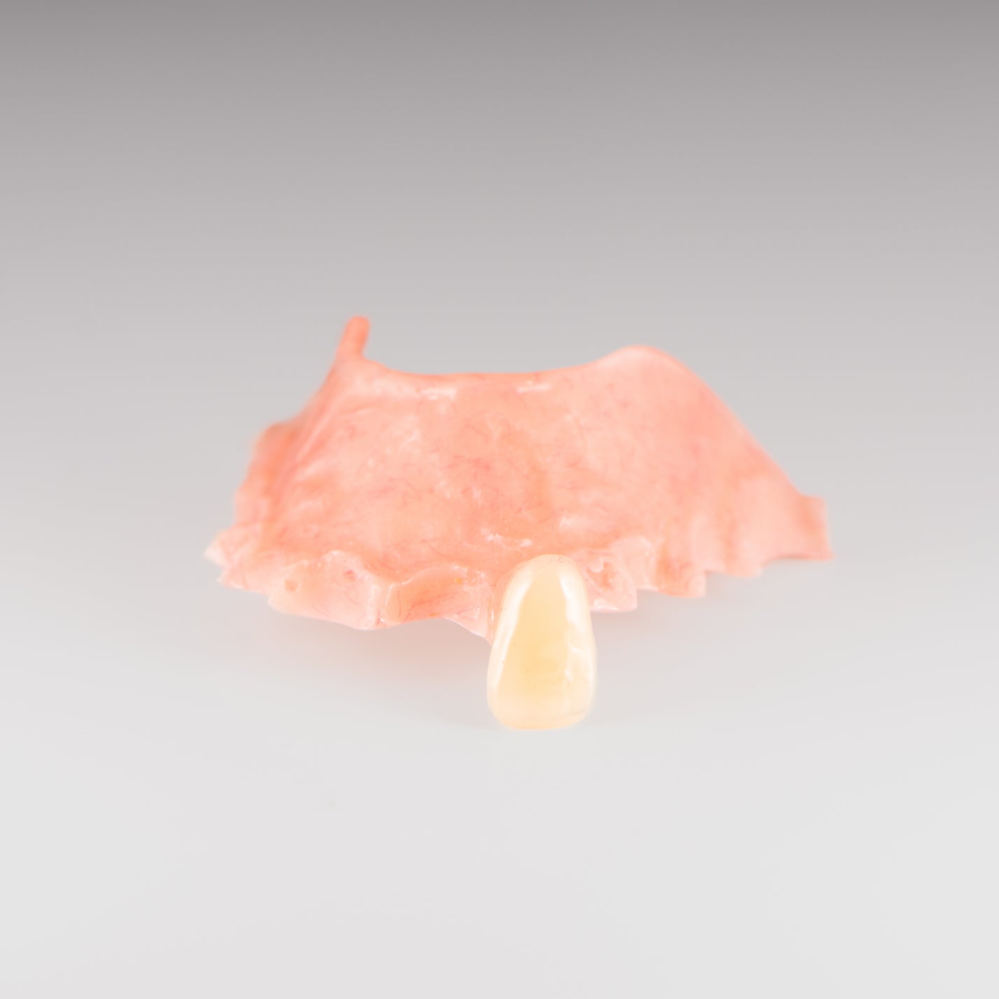 Acrylic Partial Denture - Upper & Lower Flipper Dentures – Revived Smiles