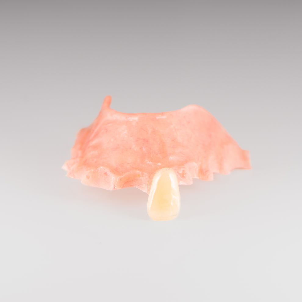 Acrylic Partial Denture - Upper & Lower Flipper Dentures – Revived Smiles
