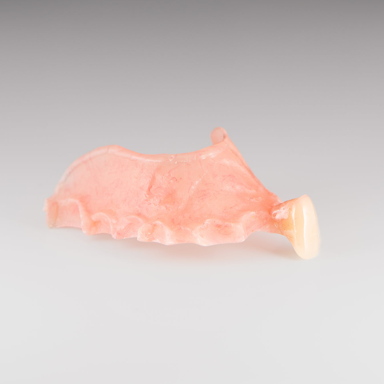 Acrylic Partial Denture - Upper & Lower Flipper Dentures – Revived Smiles