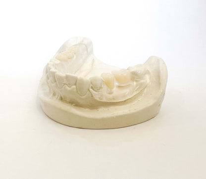 Clear Flexible Partial Denture - Revived Smiles