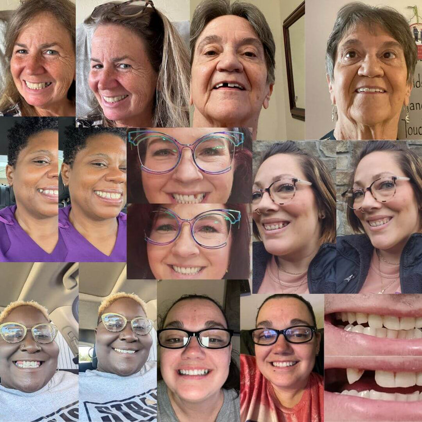 Revived Smiles l Affordable At-Home Dental Appliances