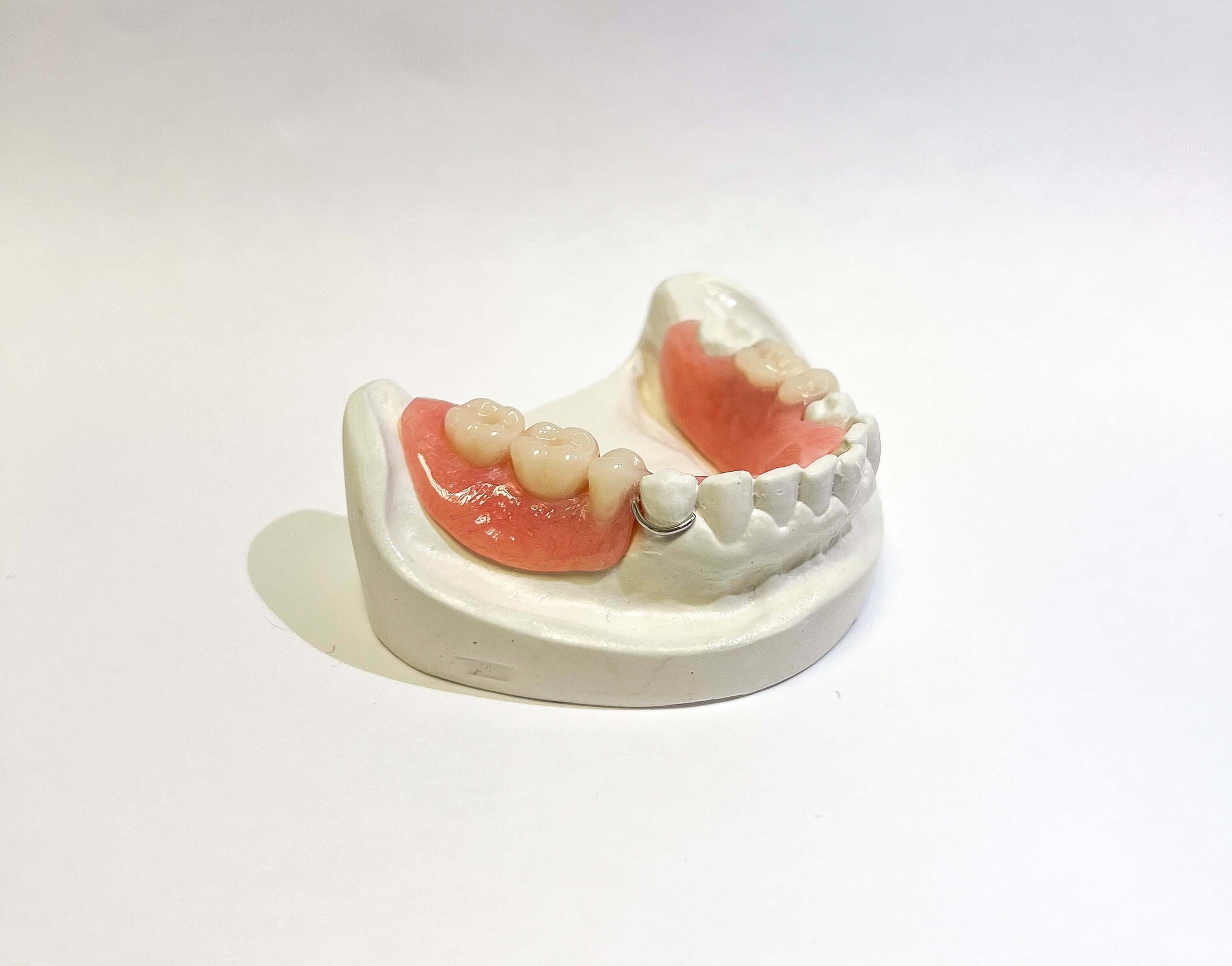 Affordable Acrylic Partial Denture Flipper - Revived Smiles