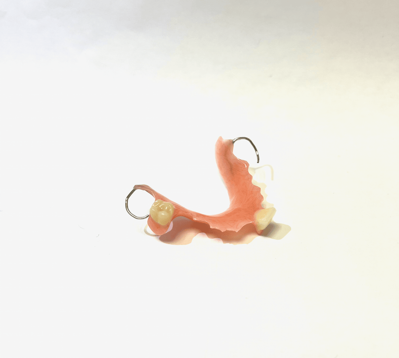 Affordable Acrylic Partial Denture Flipper - Revived Smiles