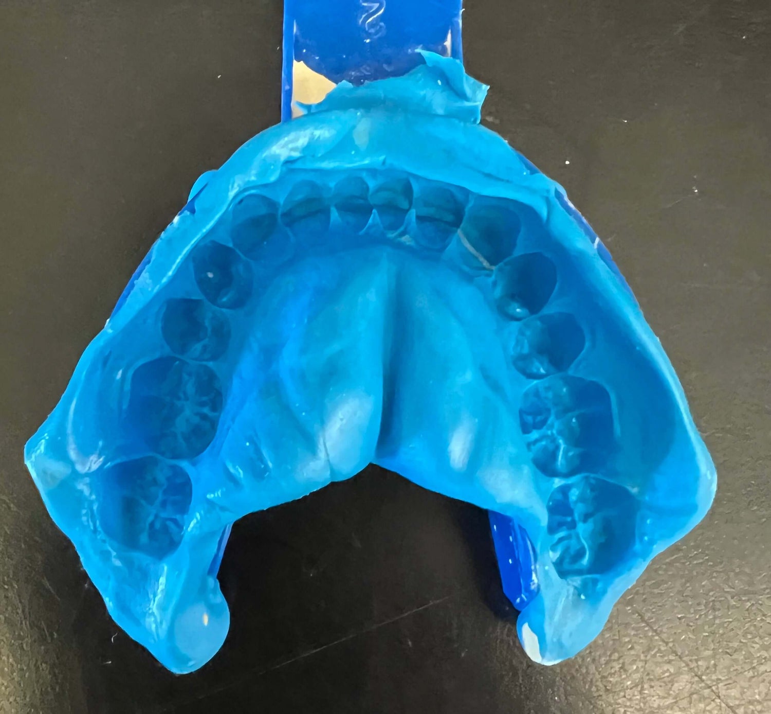 Our Quick and Easy Process! - Revived Smiles