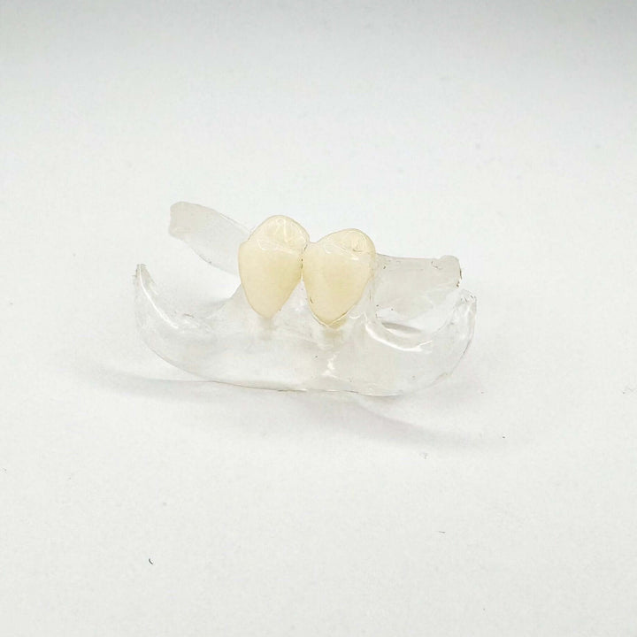Clear Unilateral Partial Denture: Perfect Fit, Ultimate Comfort