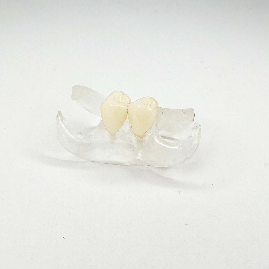 Clear Unilateral Partial Denture - Buy Online