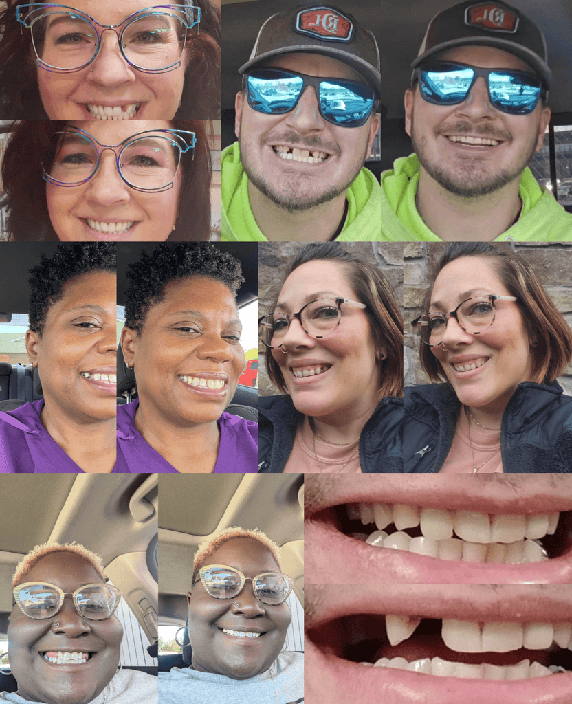 Revived Smiles l Affordable At-Home Dental Appliances