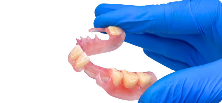 ¿Por qué elegir la dentadura Nesbit parcial unilateral? – Revived Smiles